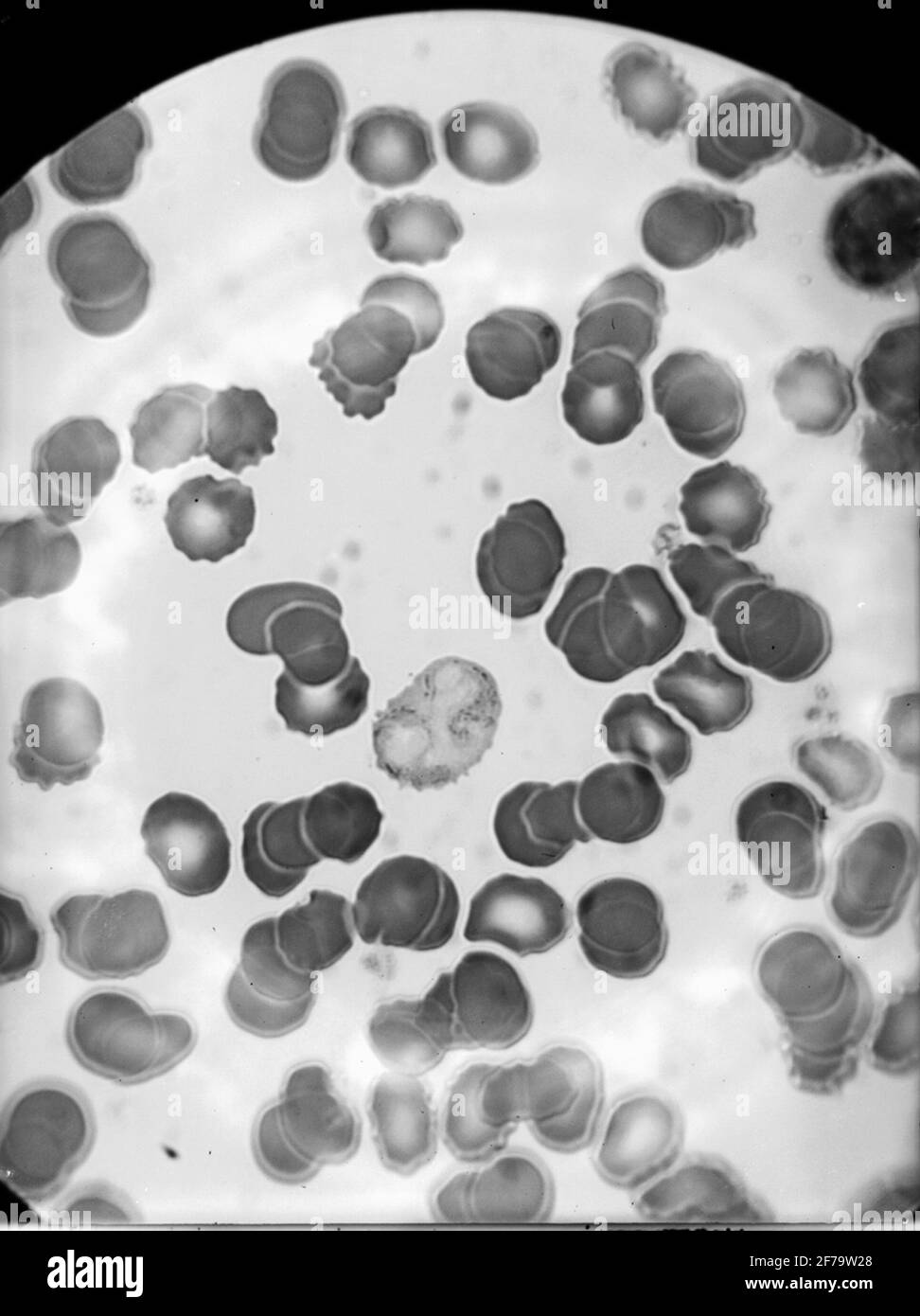 Micrograph Black and White Stock Photos & Images - Alamy