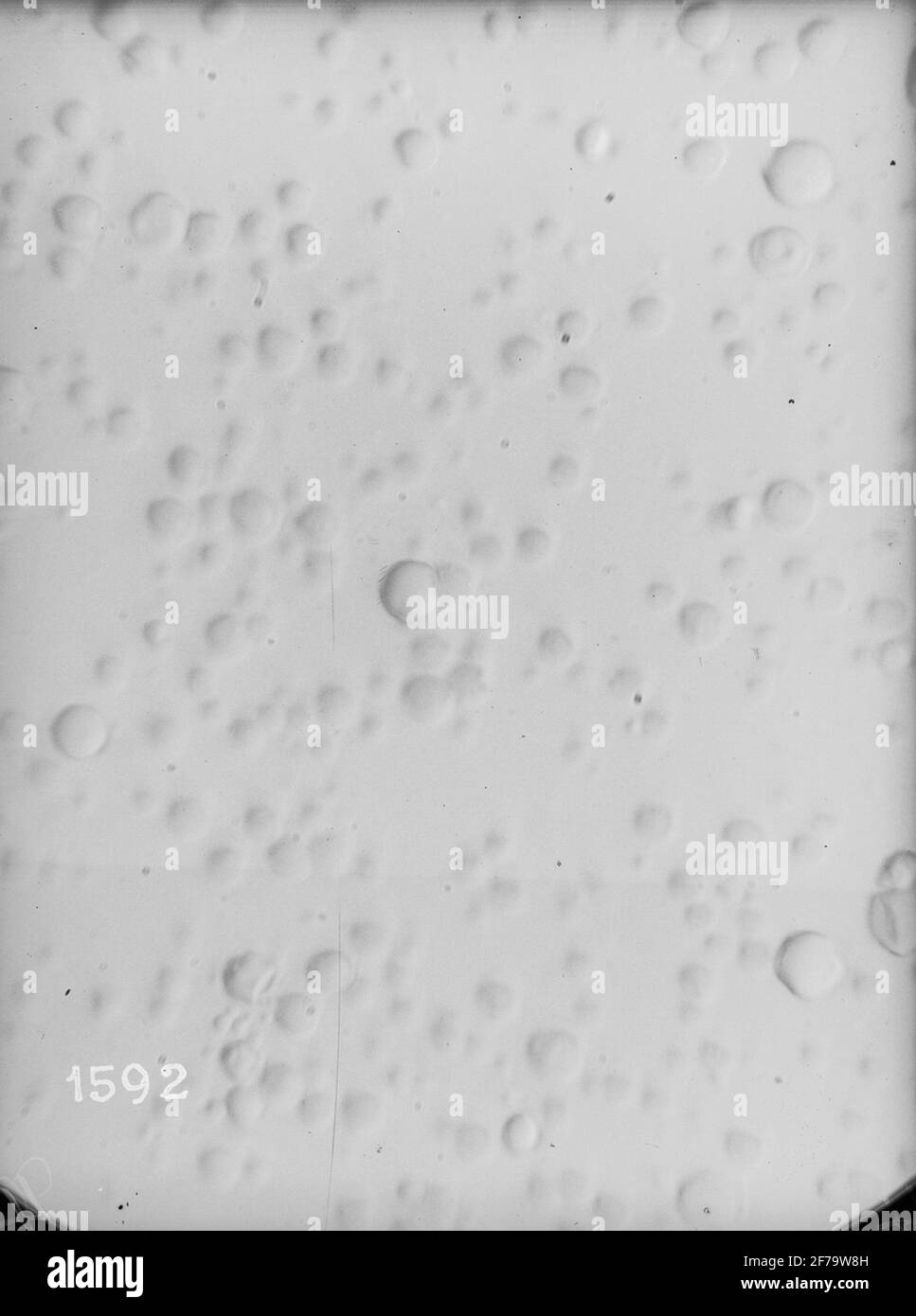 Micrographs of milk, stored in different ways. Each photography ...