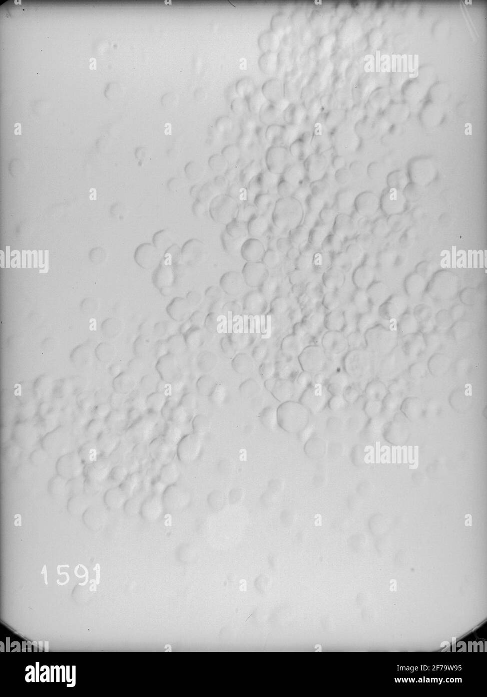 Micrographs of milk, stored in different ways. Each photography ...