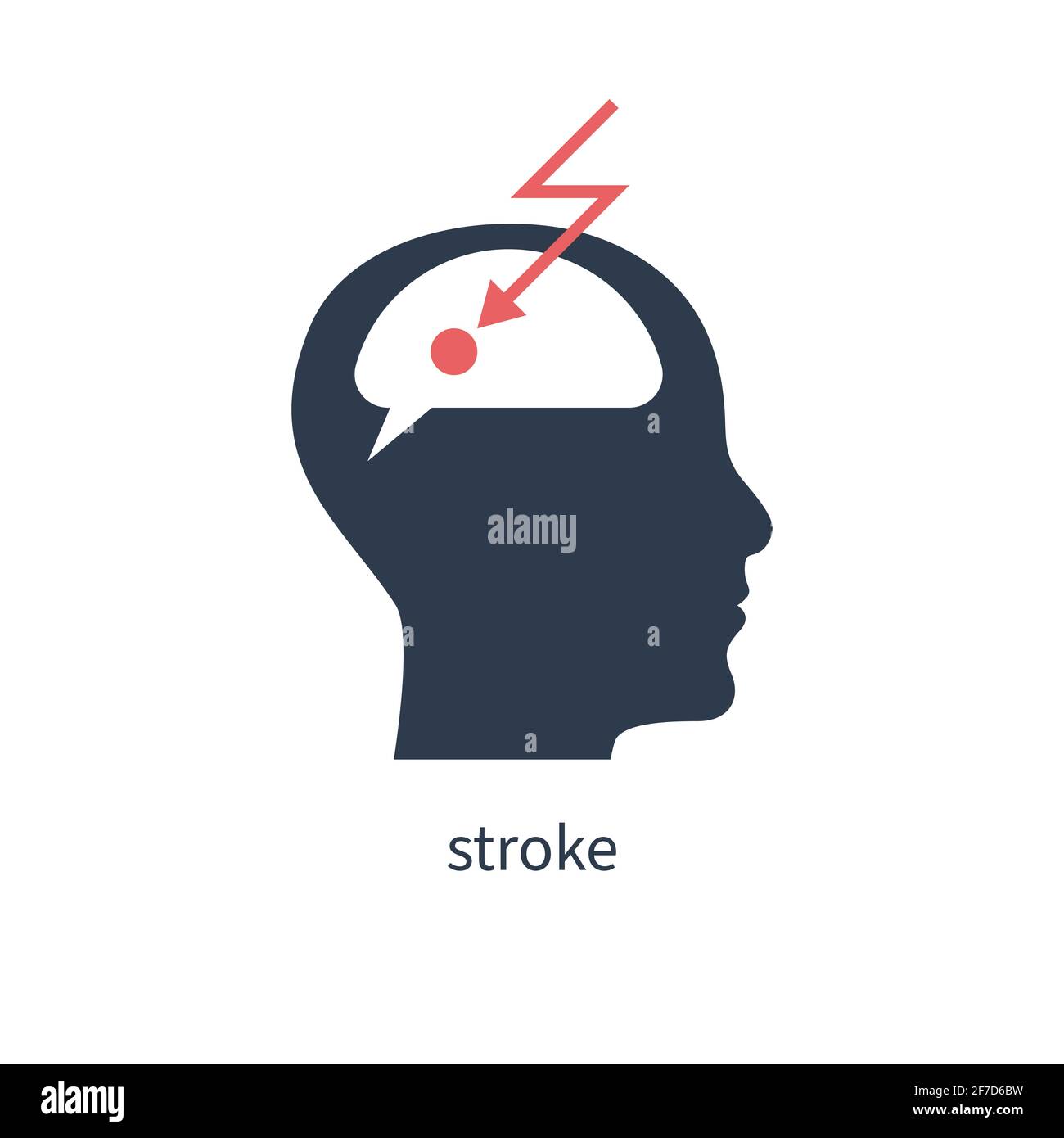 Ischemic stroke of brain icon. Vector illustration Stock Vector Image ...