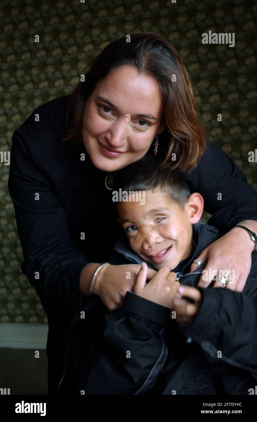 ALI HUSSEIN WITH SARAH DRIVER-JOWETT. ALI ,FROM IRAQ,WAS BADLY HURT ...