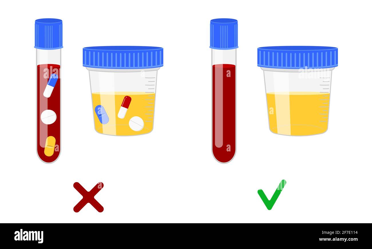 Blood and urine samples with and without different drugs. Doping ...