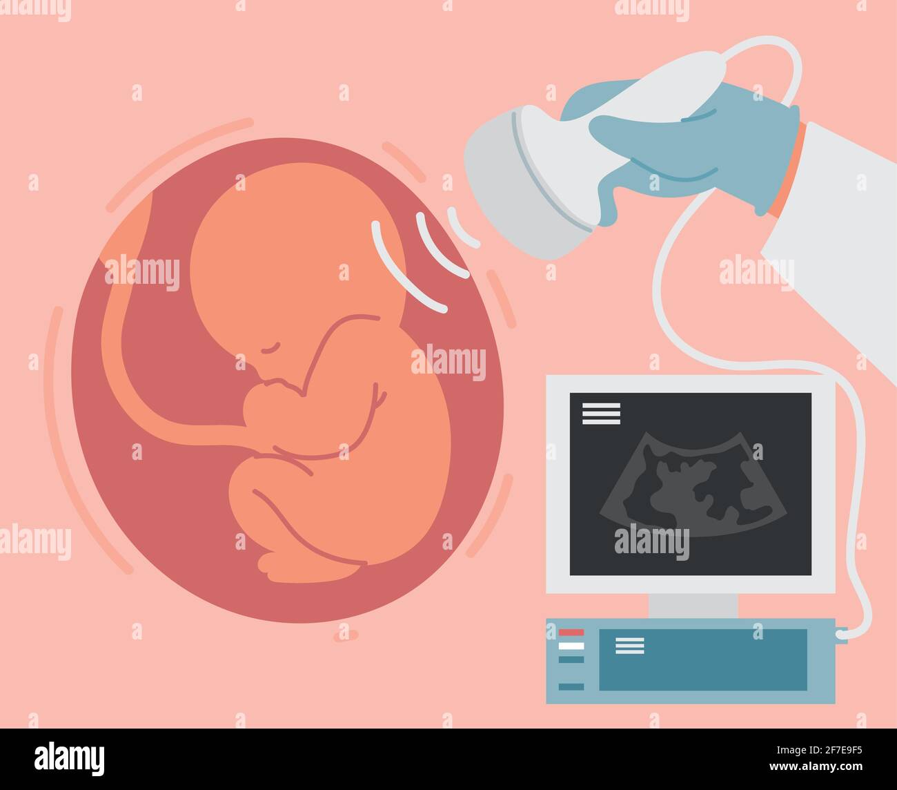 ultrasound scan of baby Stock Vector Image & Art - Alamy