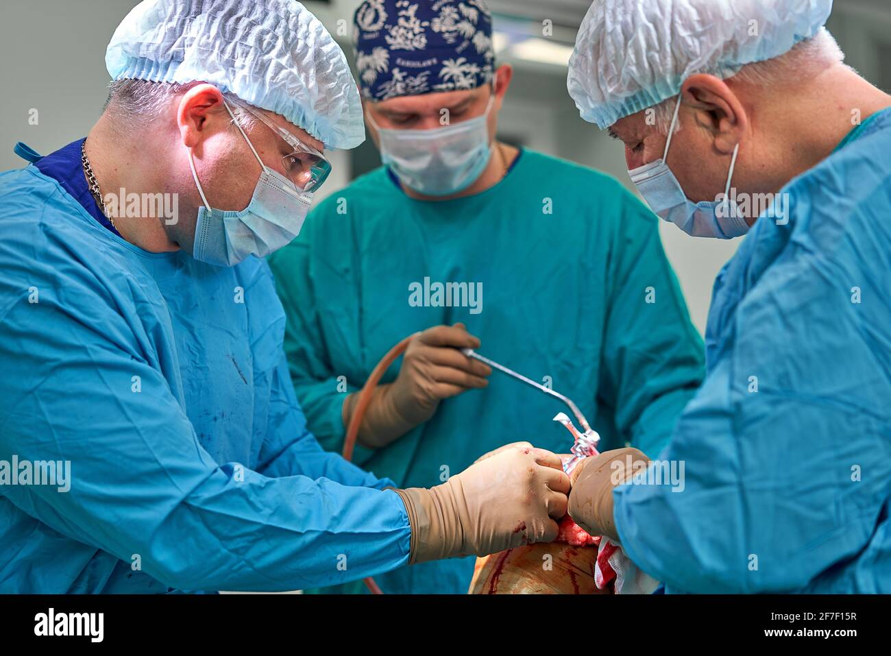 doctors work hard in the operating room Stock Photo - Alamy