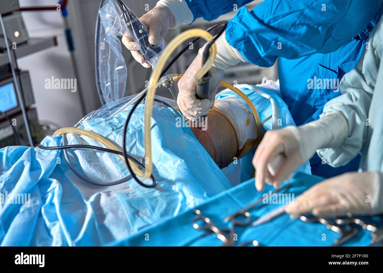 Doctor trying to resolve a knee joint trauma Stock Photo - Alamy