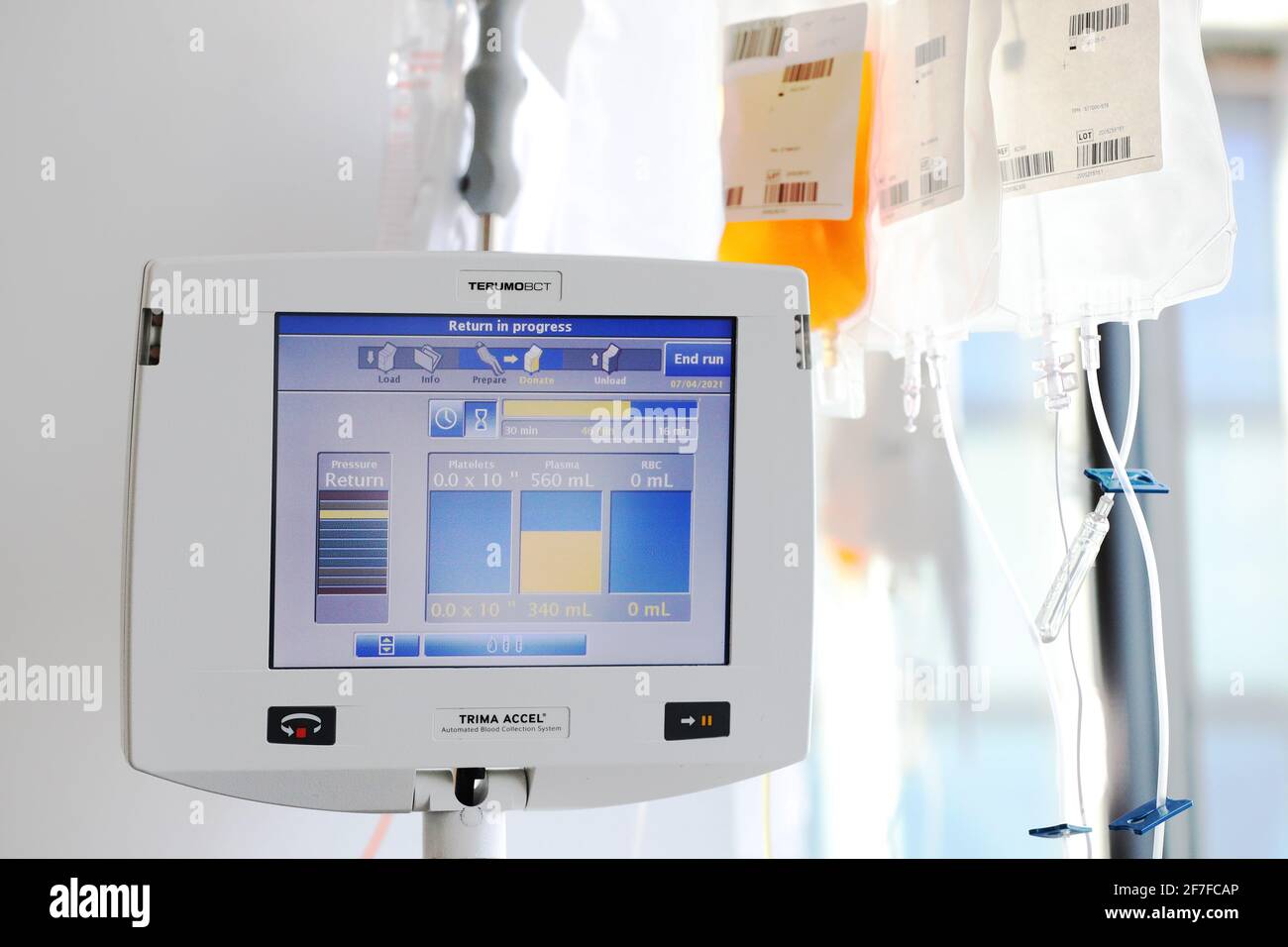 The screen of an apheresis machine which separates plasma from blood as ...