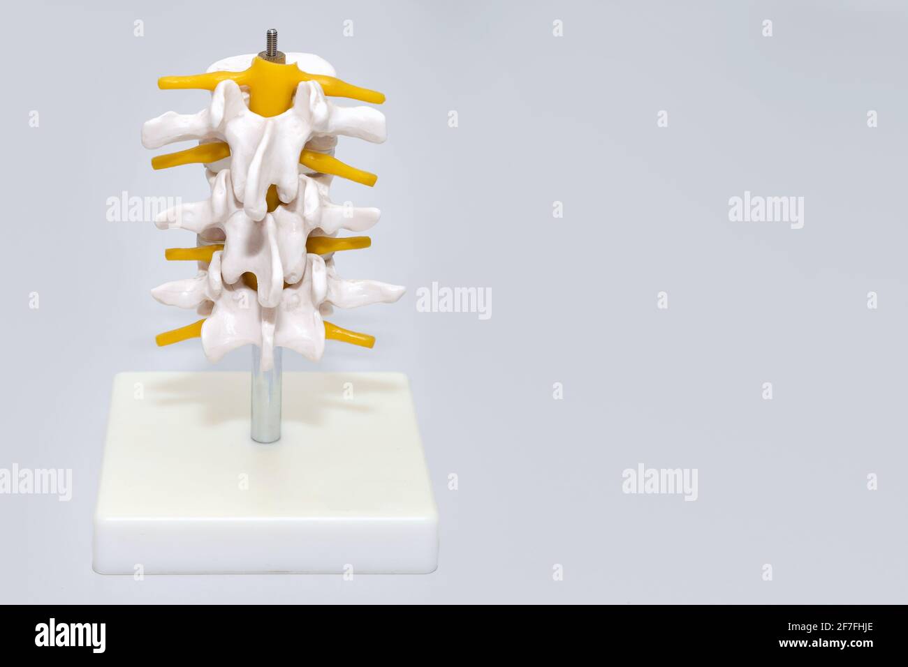 Human spine plastic model for surgery in clinic. Anatomical models of ...