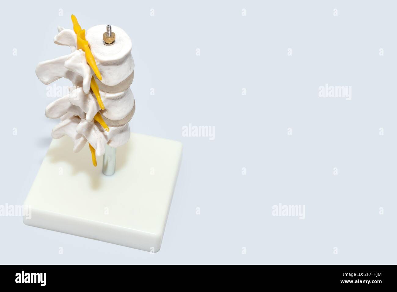 Human spine plastic model for surgery in clinic. Anatomical models of ...