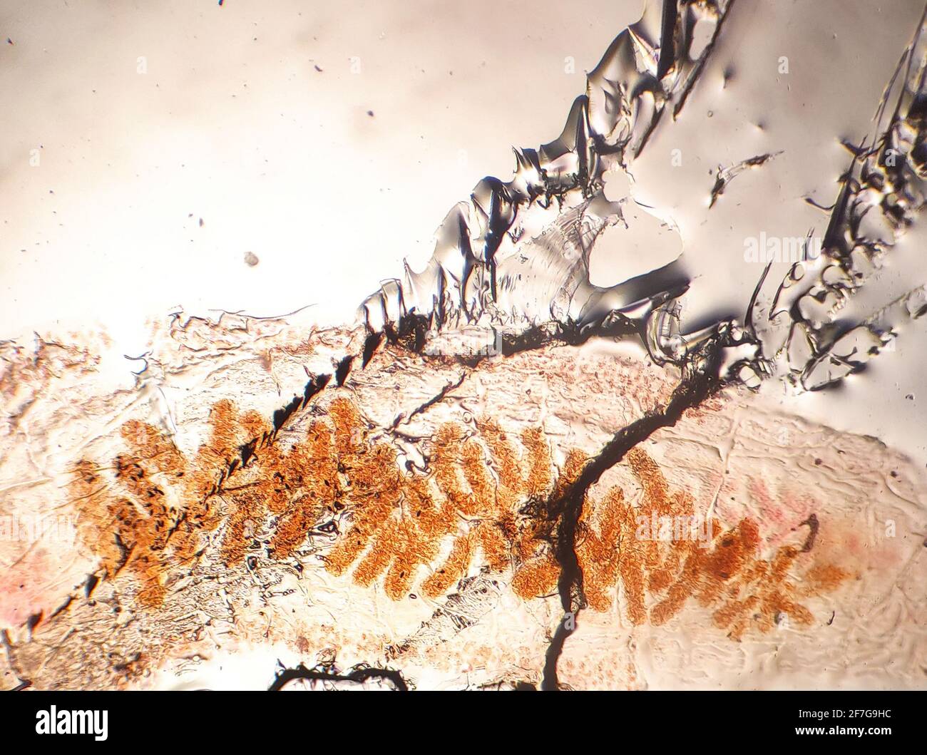 Pinworm hi-res stock photography and images - Alamy