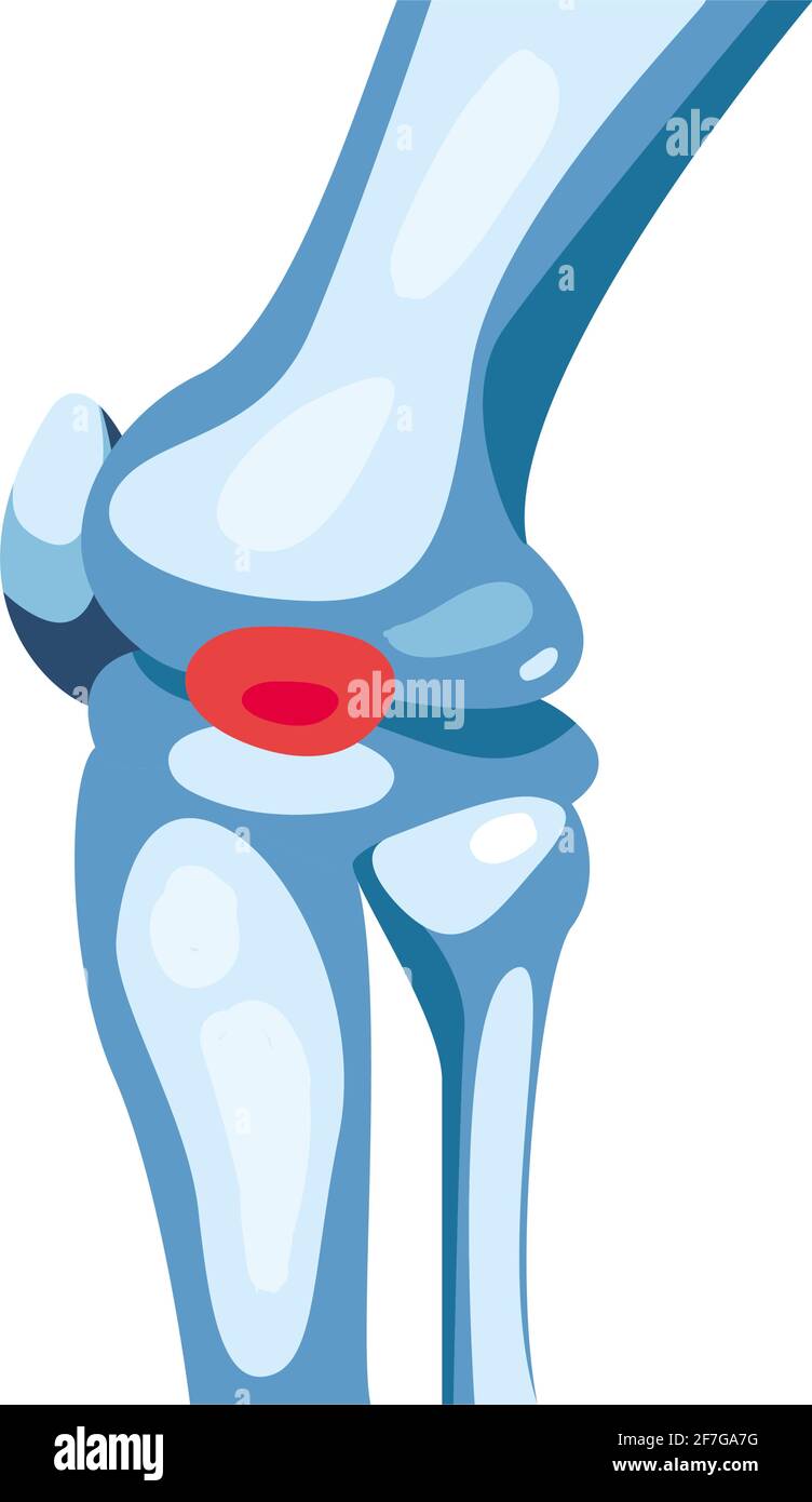Traumatology orthopedic surgery knee Stock Vector Images - Alamy