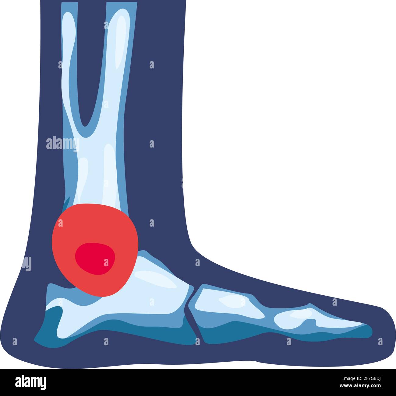 X ray scan foot Stock Vector Images - Alamy