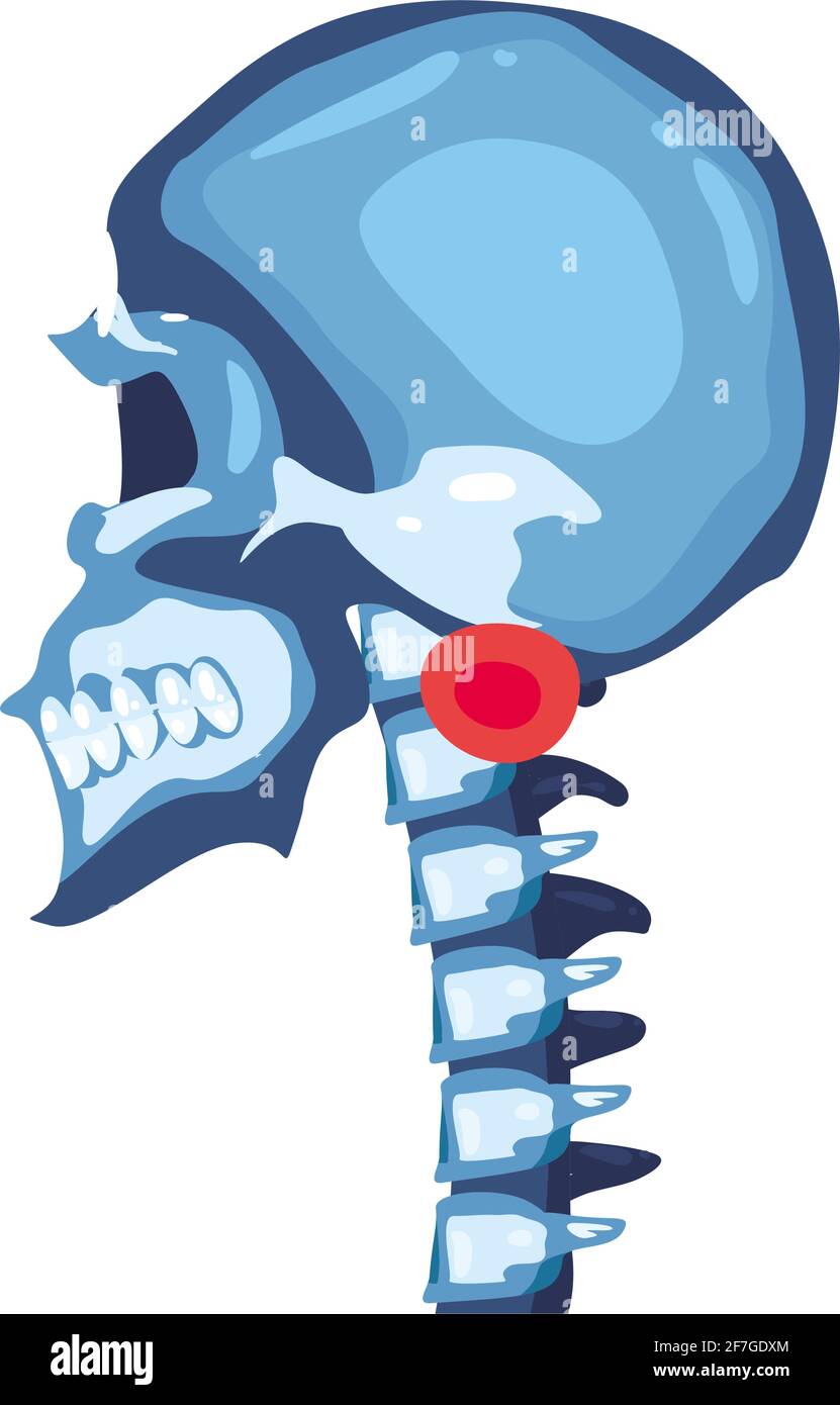 Spine Skull High Resolution Stock Photography and Images - Alamy