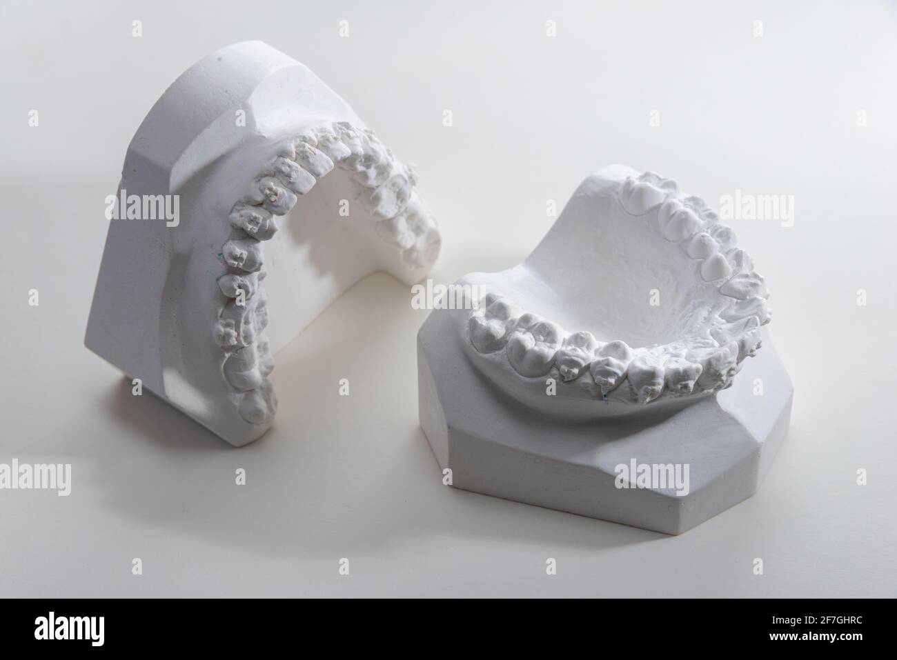 Dental model plaster cast or mould human jaws prothetic on white ...
