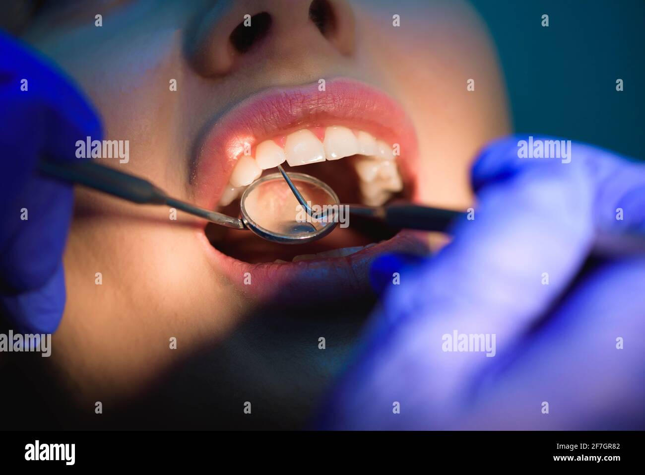 Doctor in uniform checking up female patient's teeth in dental clinic ...