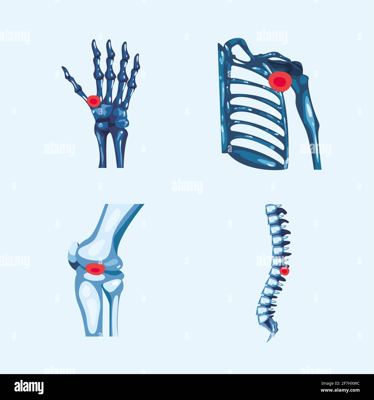Rheumatology blue bones icon collection Stock Vector Image & Art - Alamy