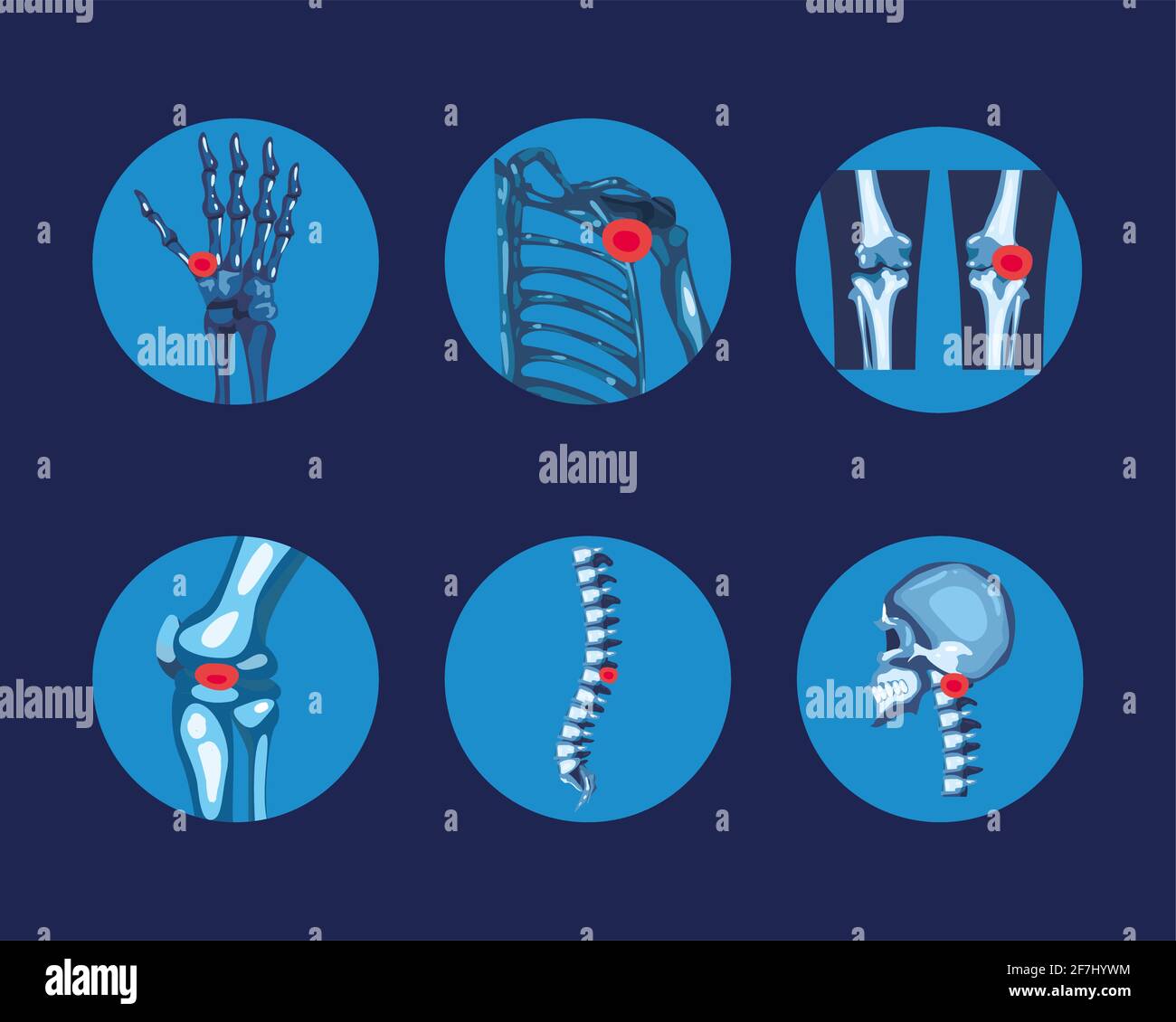 Rheumatology hand bones Stock Vector Images - Alamy