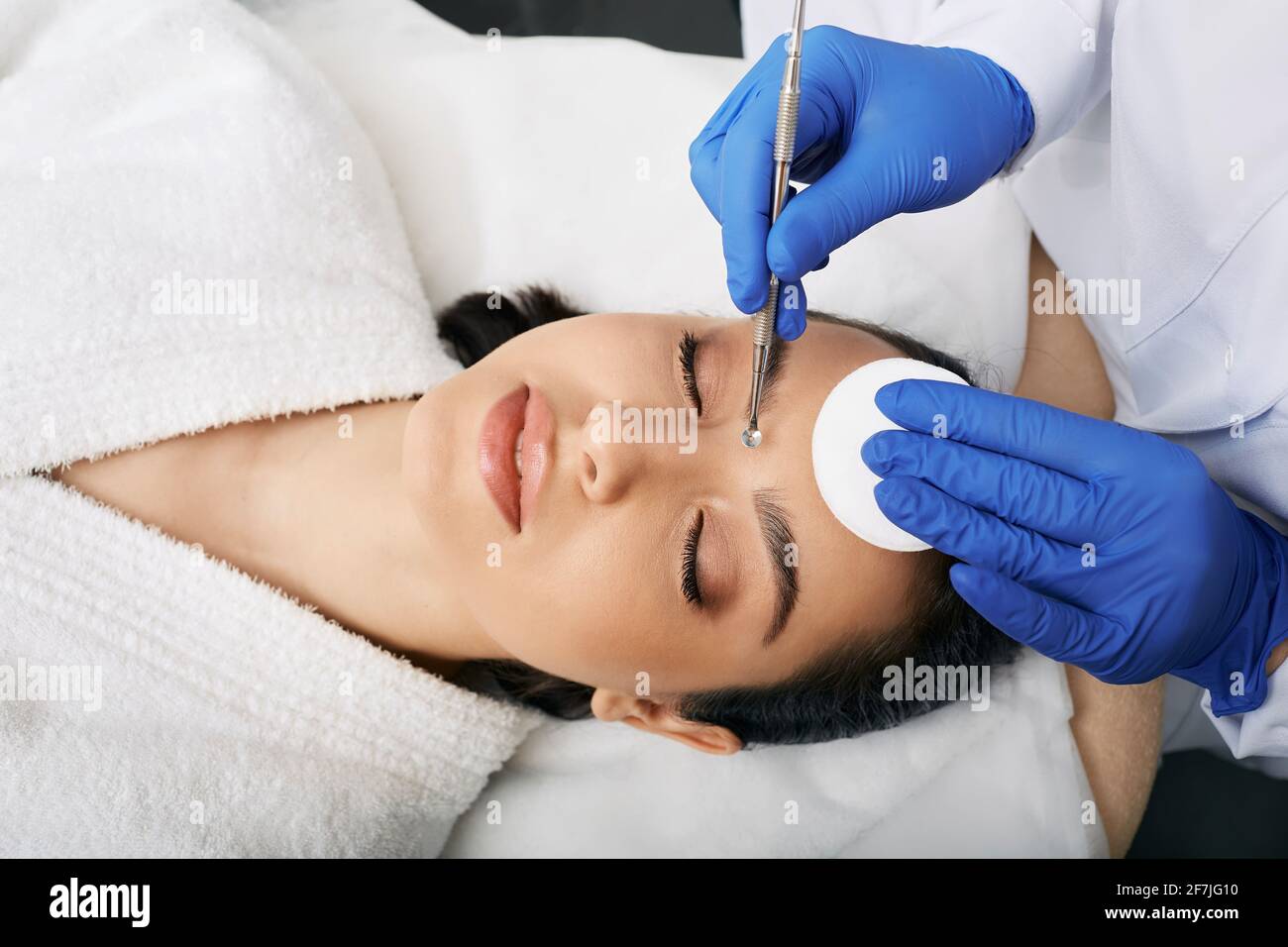 Comedones hi-res stock photography and images - Alamy