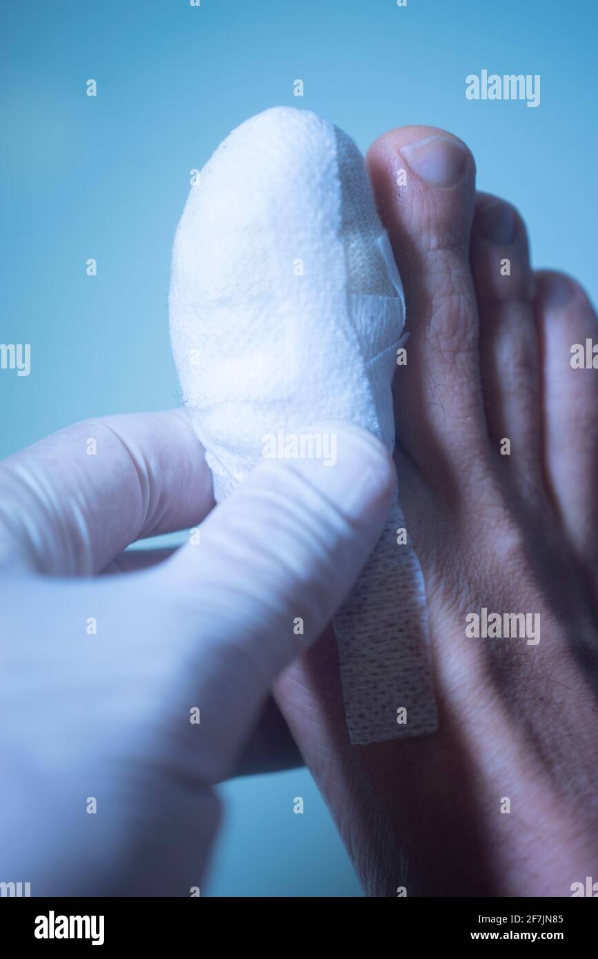 Foot big toe bandage injured feet in medical clinic hospital center ...