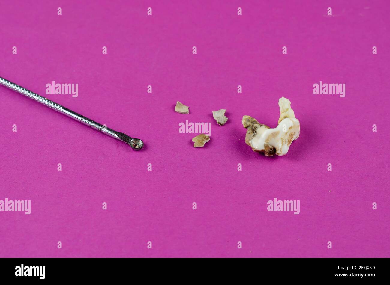 Large animal tooth, plaque and dental scraper on magenta background ...