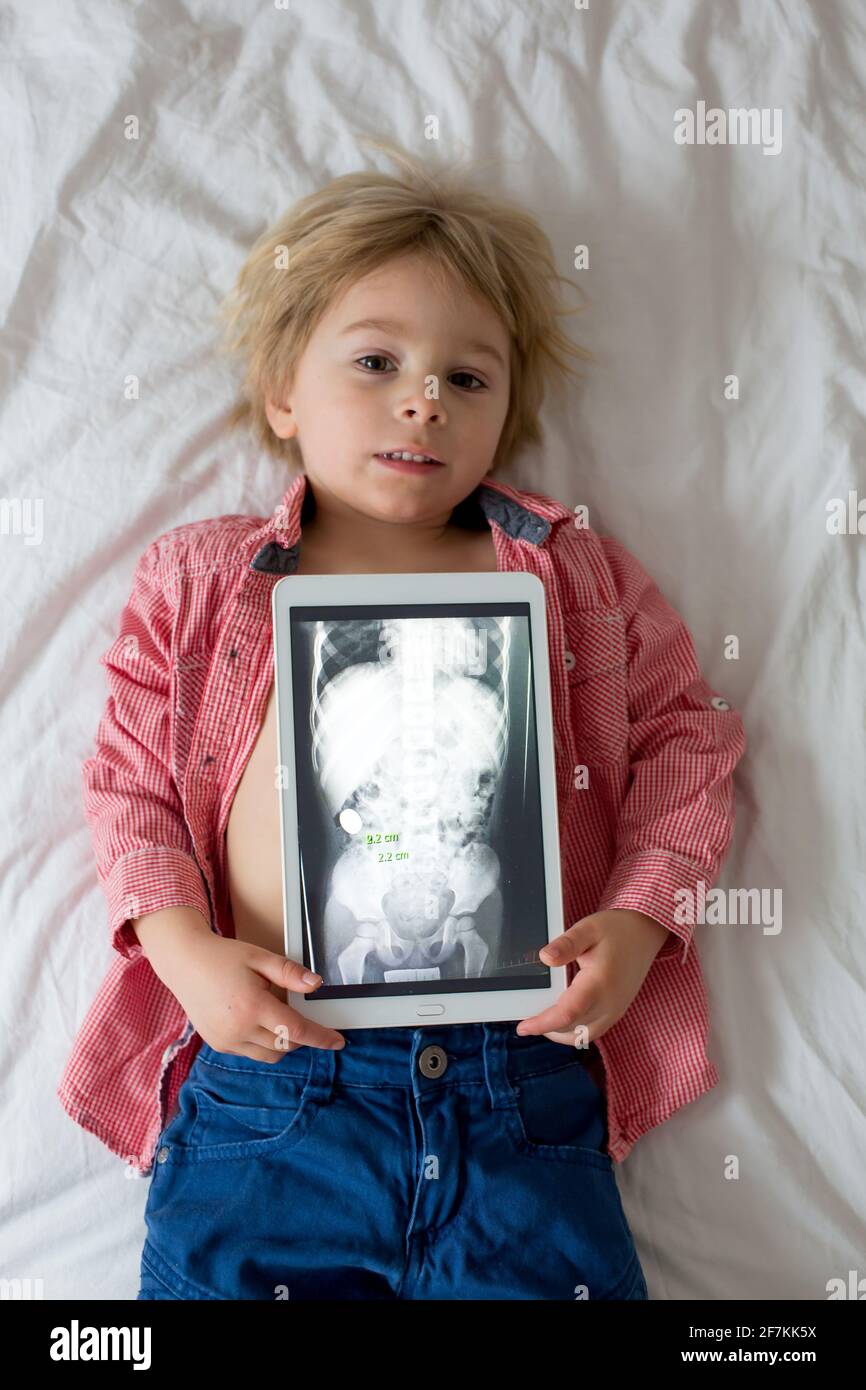 Toddler child, blond boy, holding x-ray picture on tablet of child body ...