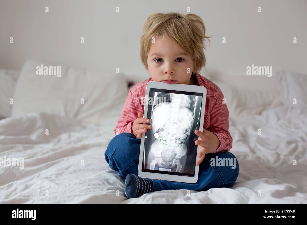 Toddler child, blond boy, holding x-ray picture on tablet of child body ...