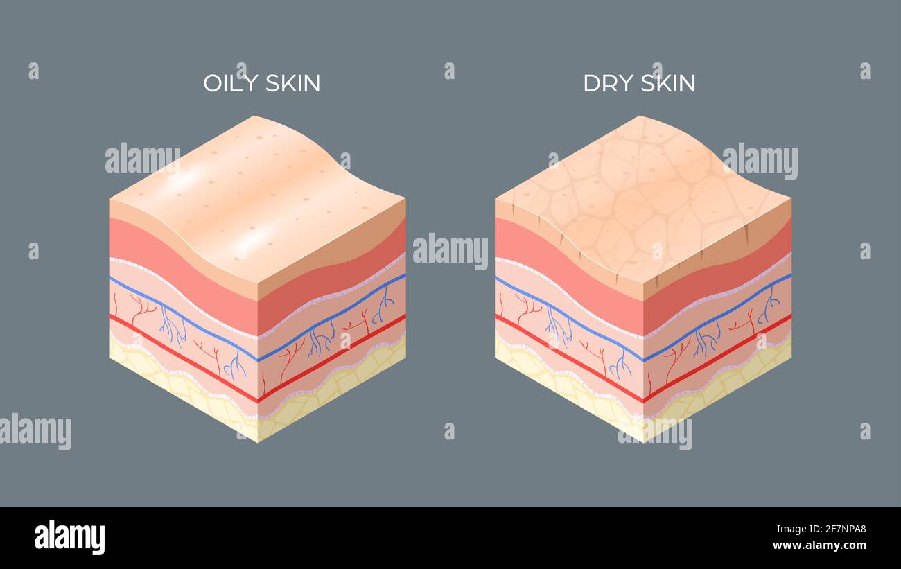 oily and dry skin cross-section of human skin layers structure skincare ...
