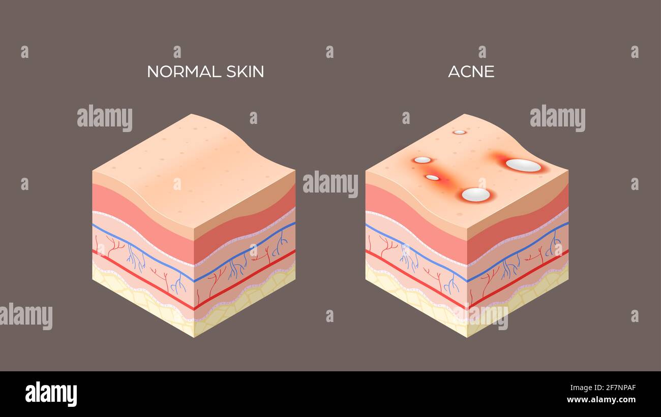 Skin integument Stock Vector Images - Alamy