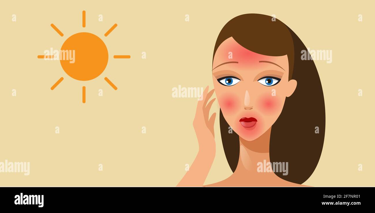 Woman After Sun Lotion Stock Vector Images Alamy