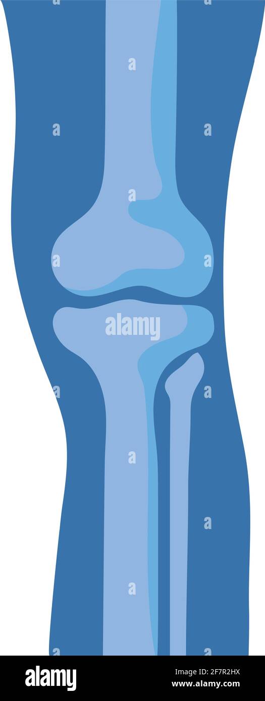 normal knee bones Stock Vector Image & Art - Alamy