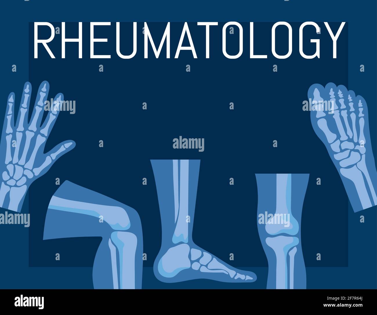 Rheumatic fingers Stock Vector Images - Alamy