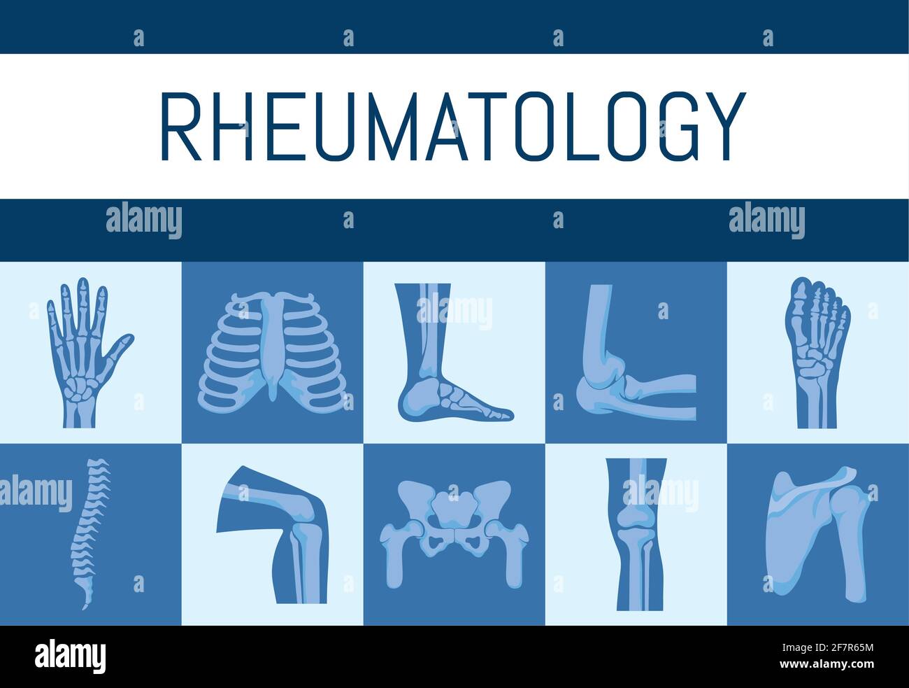 rheumatology bones poster Stock Vector Image & Art - Alamy
