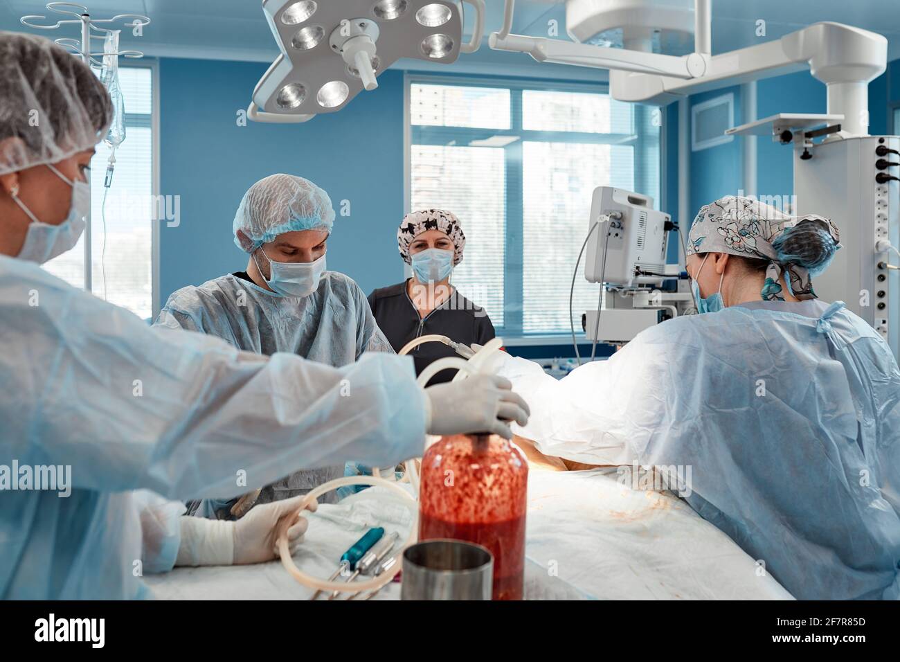 cosmetic liposuction surgery in actual operating room setting showing ...