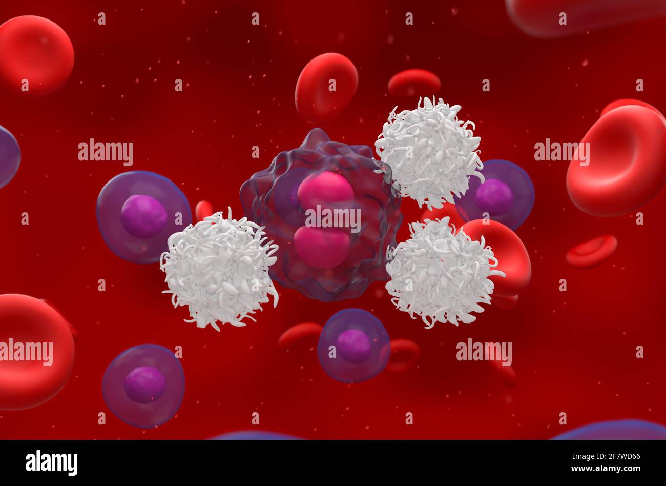 Activated t-cells attack and destroy a divided lymphoma cell 3d render ...