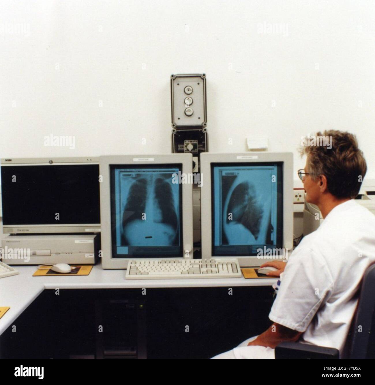 A doctor looks on a screen to rontgen photos Stock Photo - Alamy