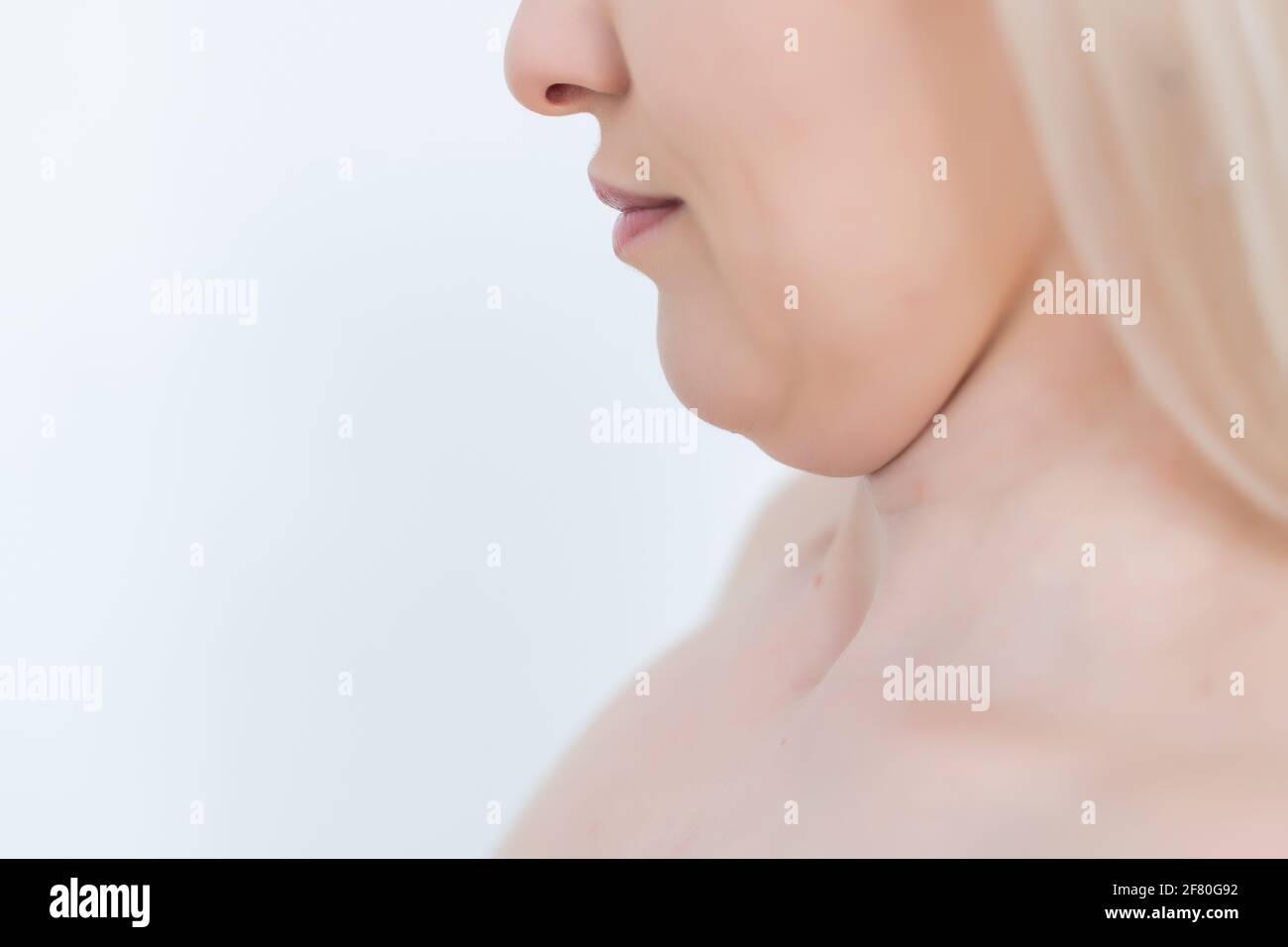 Closeup of woman's secong chin, problems with excess weight. Woman is ...