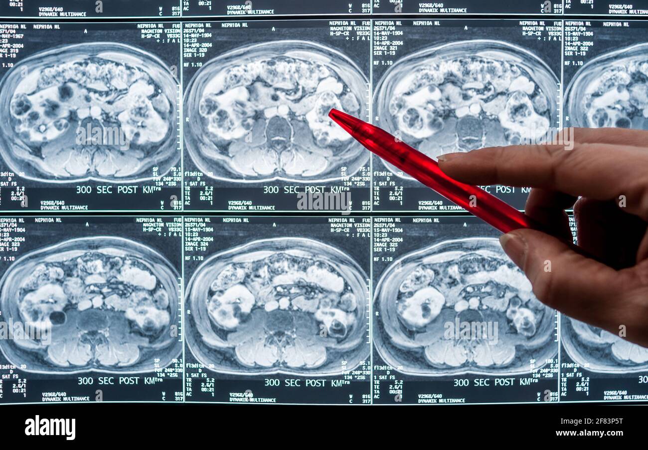 Magnetic resonance imaging, MRI, computed tomography, x-ray image ...