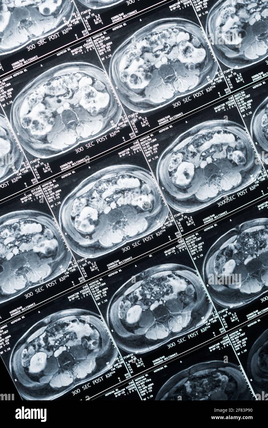 Magnetic resonance imaging, MRI, computed tomography, x-ray image ...