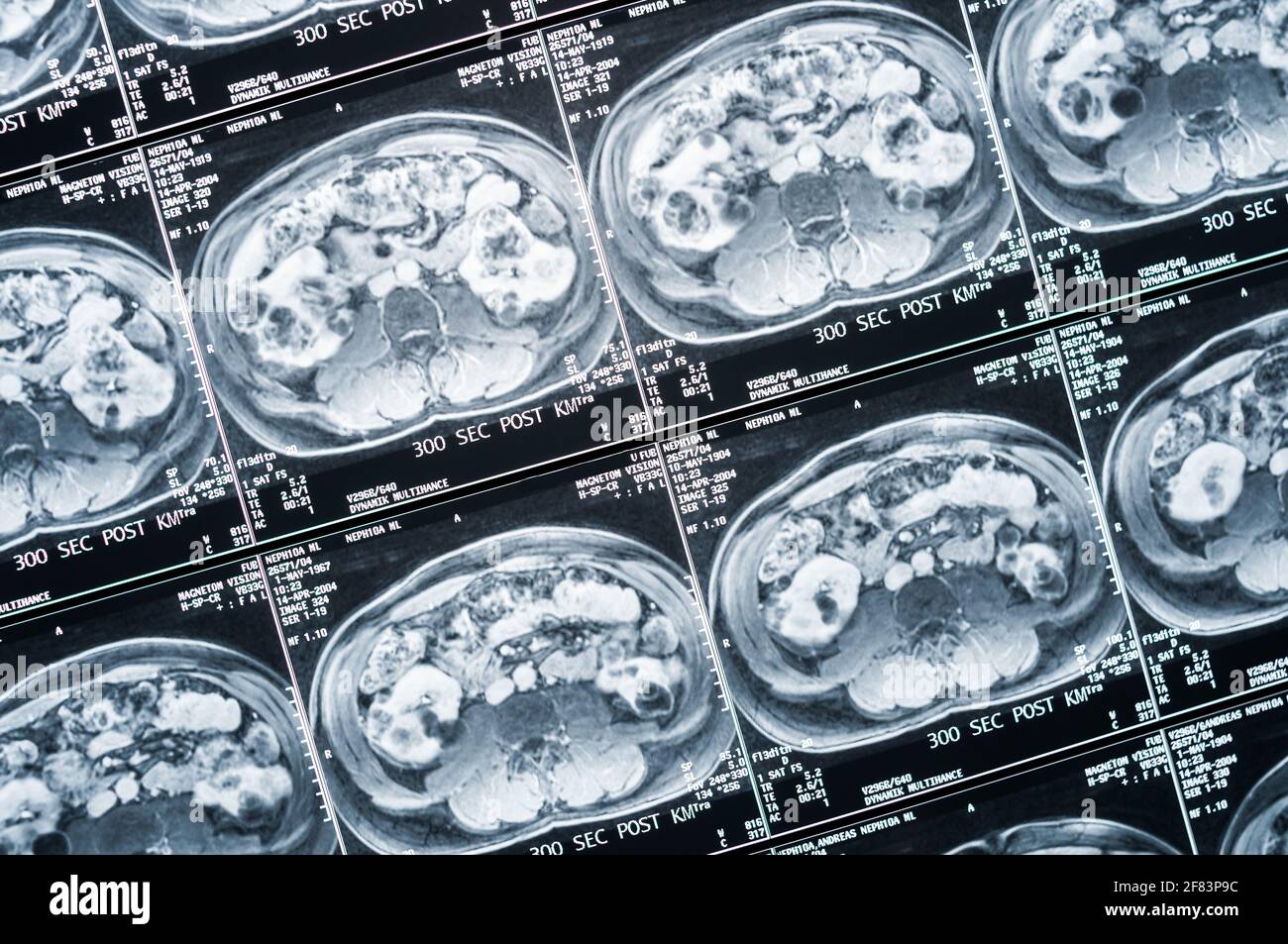 Magnetic resonance imaging, MRI, computed tomography, x-ray image ...