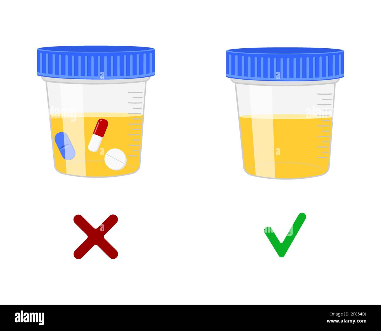 Urinalysis, urine samples with and without drugs. Doping control in ...