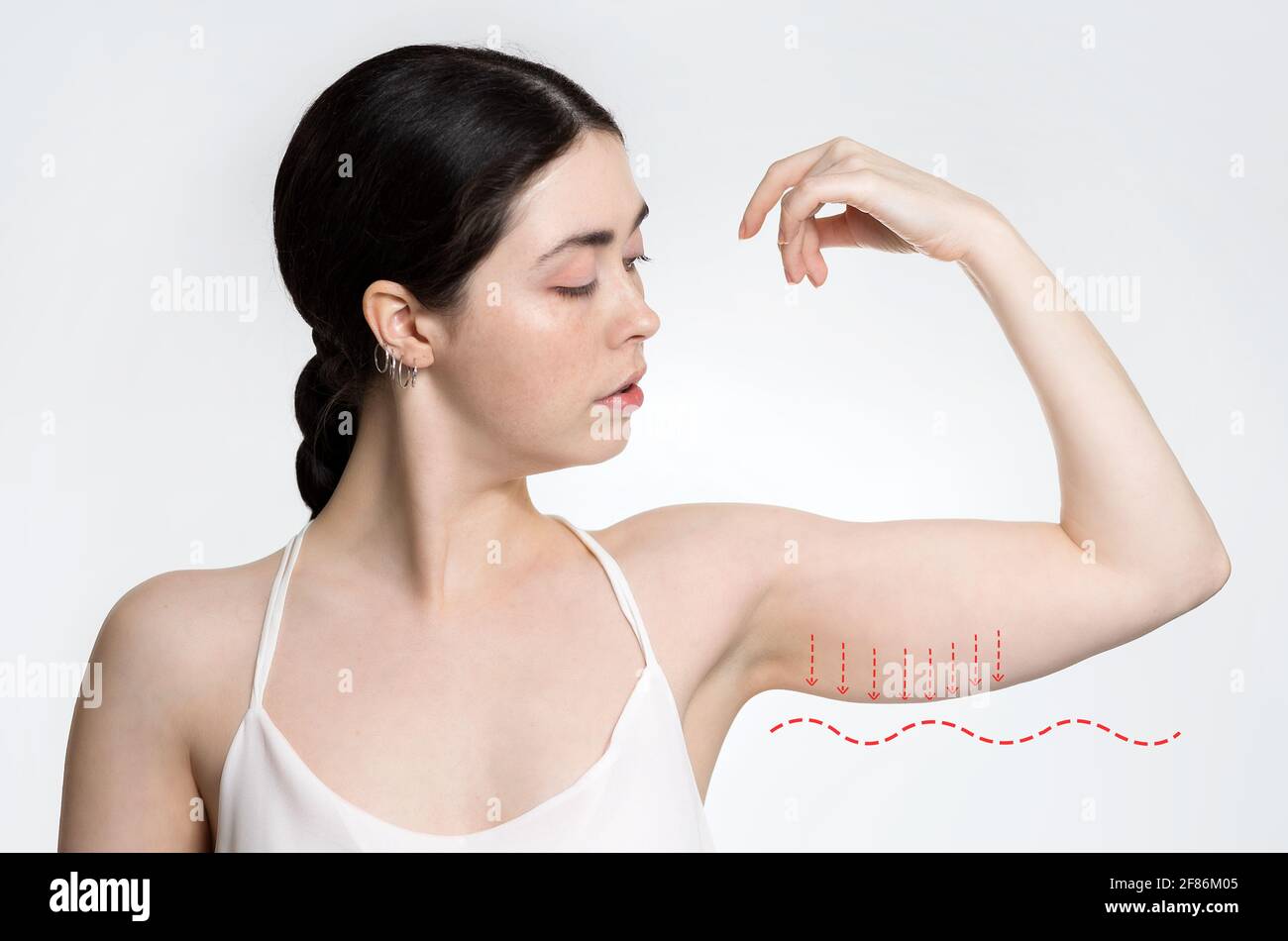 A young woman shows her hand, with sagging skin. White background. The ...