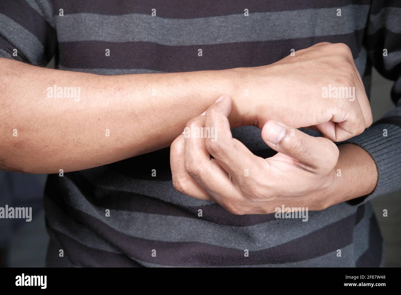 Man suffering from itching skin hi-res stock photography and images - Alamy