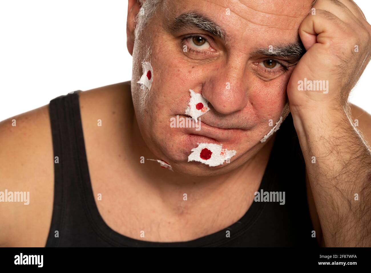 unhappy middle aged man with blood on his face on white background ...