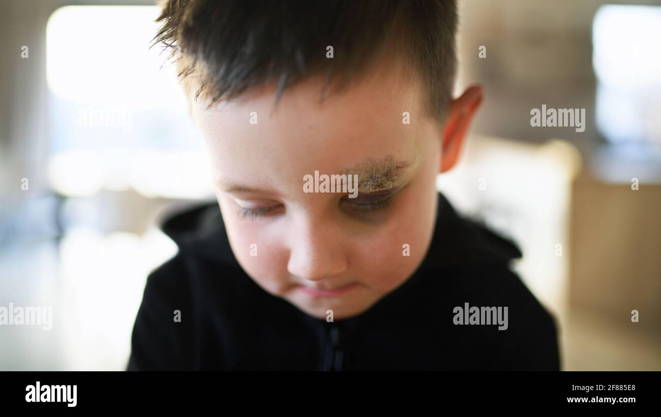 Poor sad small boy with cut eyebrow standing indoors at home, poverty ...