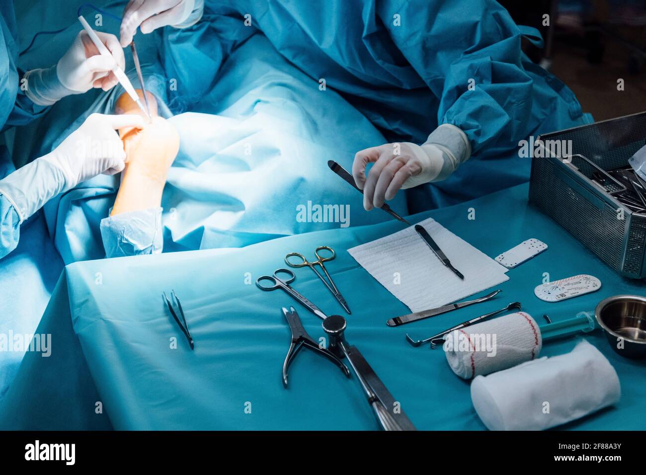 Professional medical team performing surgery at the hospital Stock ...