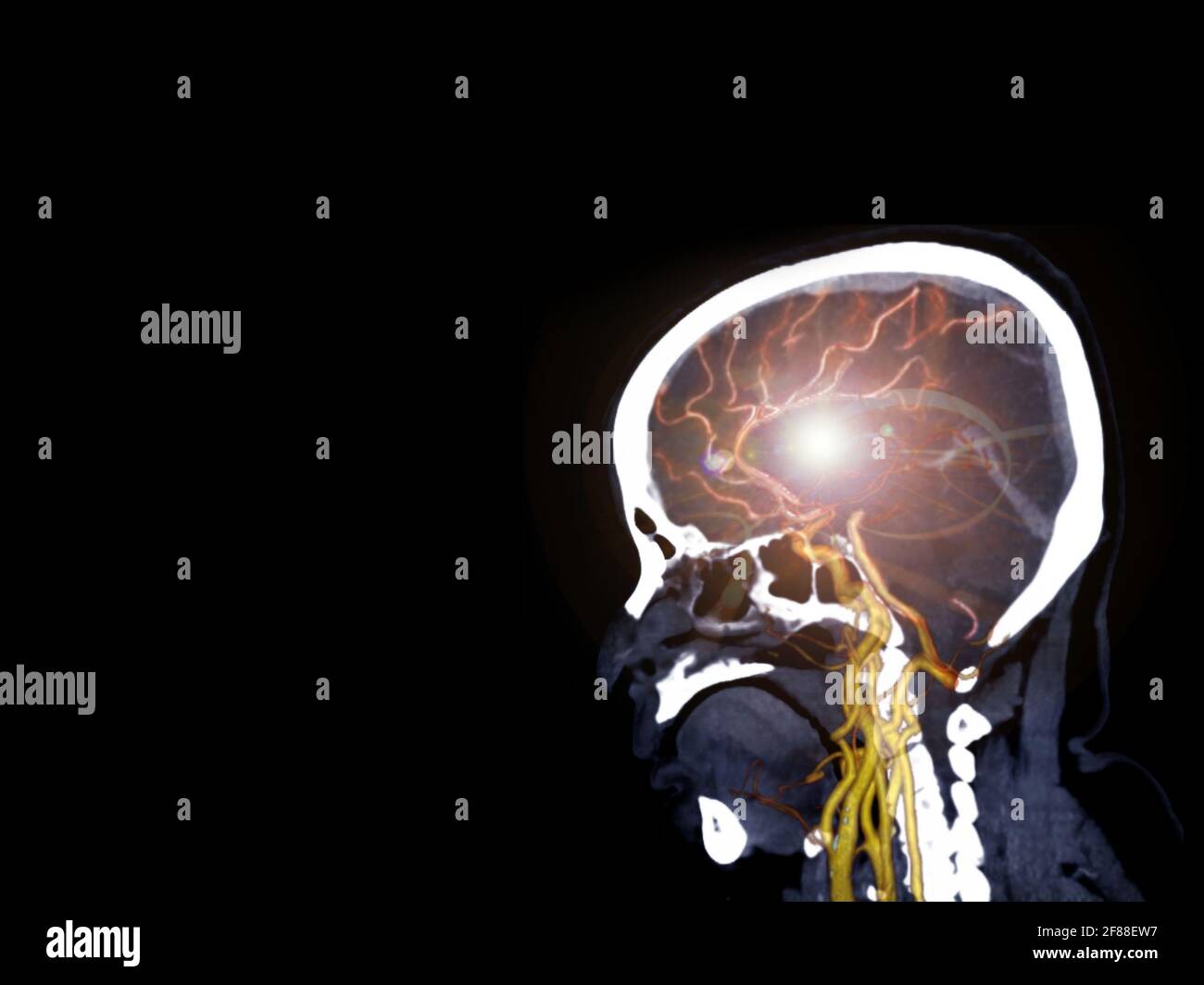 3d ct reconstruction hi-res stock photography and images - Alamy