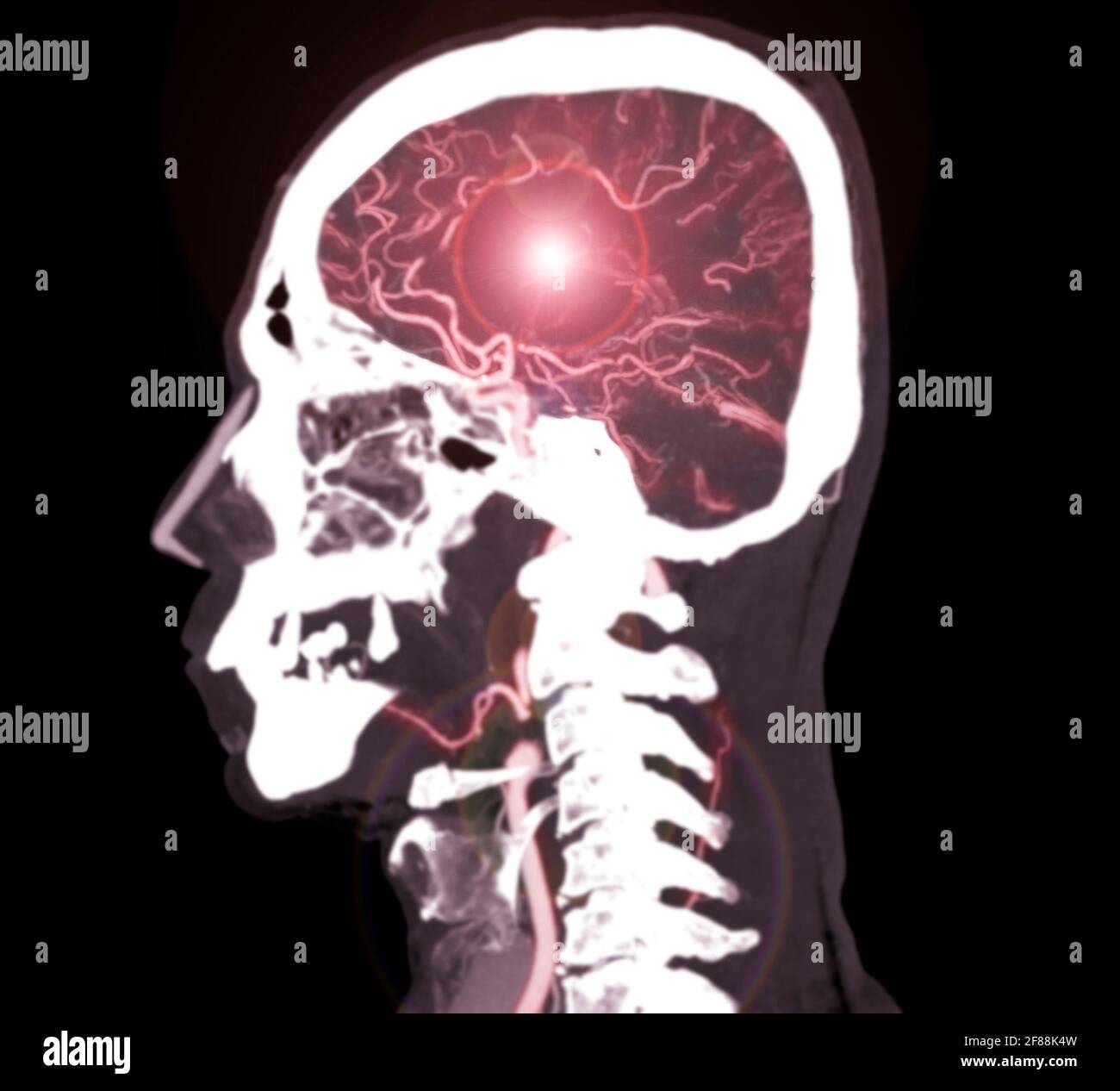 colorful of CT angiography of the brain or CTA brain sagittal view ...