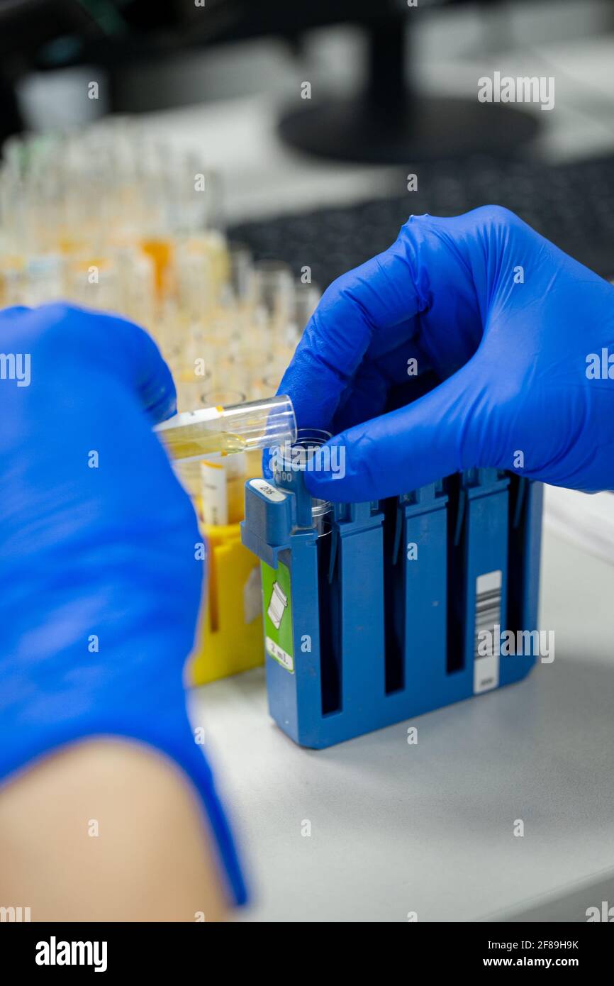 a close-up of laboratory tests in a test tube Stock Photo - Alamy
