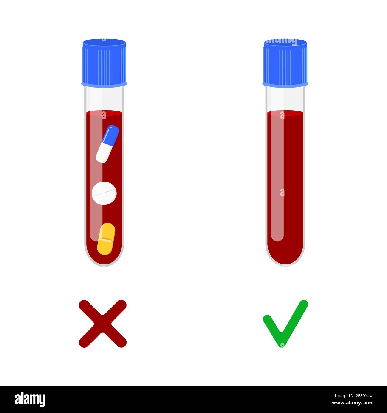 Blood samples with and without drugs. Doping control in sport, post ...