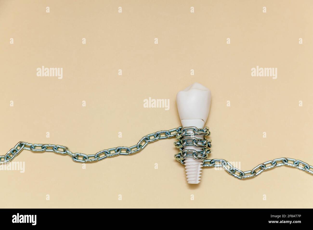 Dental implant is twisted with a metal chain on a beige background ...
