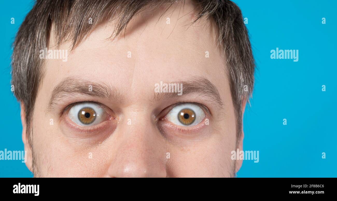Bulging eyes hi-res stock photography and images - Alamy